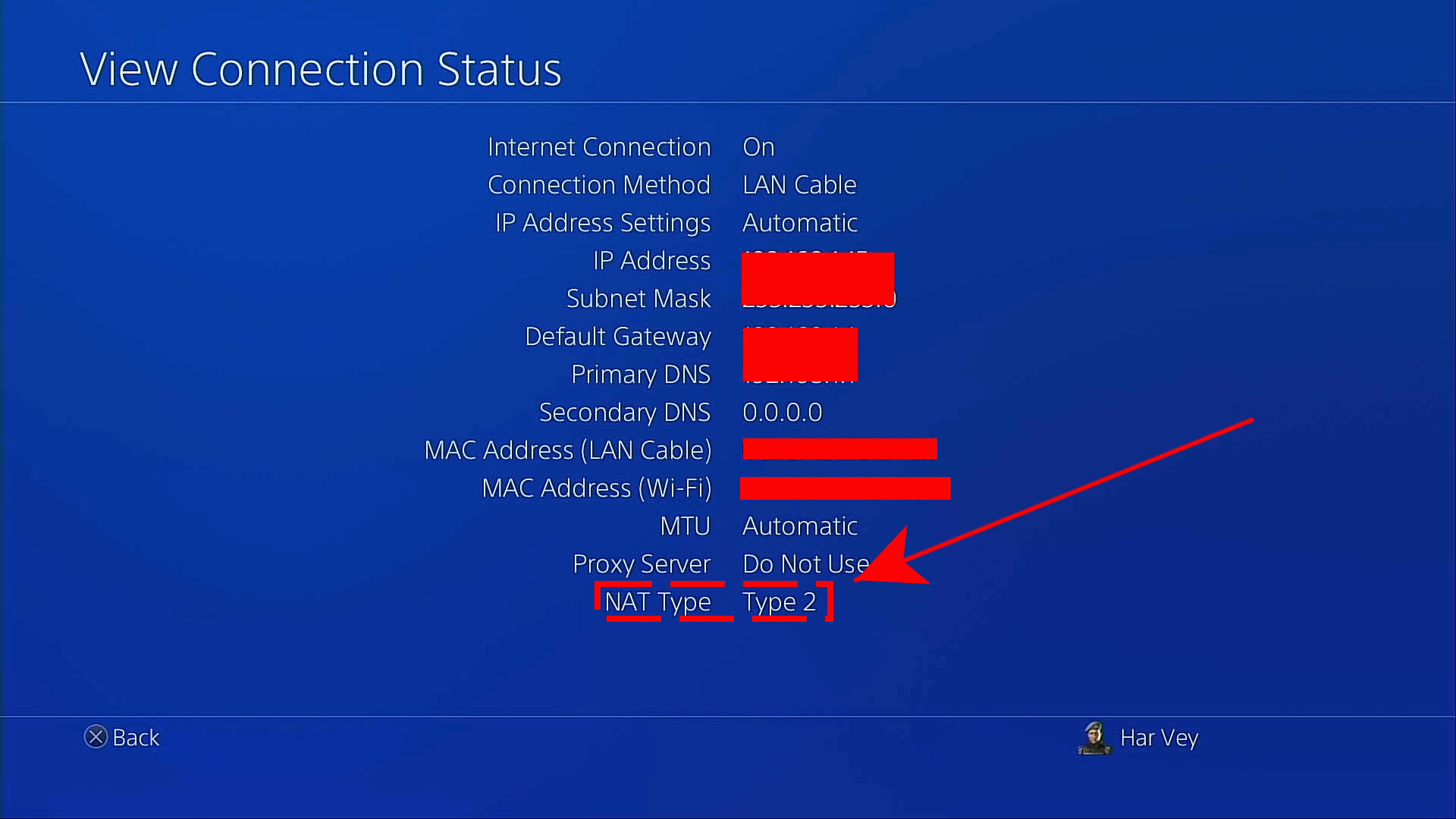 How To Find Your PS4 NAT Type (To Fix Connection Issues)| NEW in 2025! – The Droid Guy